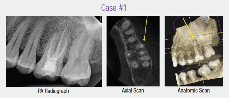 Success in Endodontics | GOLDMAN DENTAL MANAGEMENT