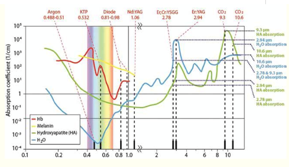 Characteristics of Absorption | GOLDMAN DENTAL MANAGEMENT