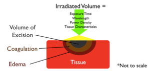Soft-Tissue Laser Model | GOLDMAN DENTAL MANAGEMENT